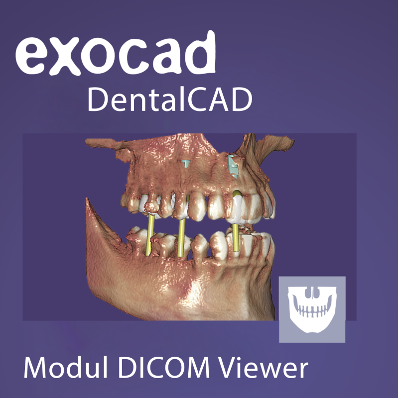exocad DentalCAD Modul DICOM Viewer – 3D Smart Dent Shop